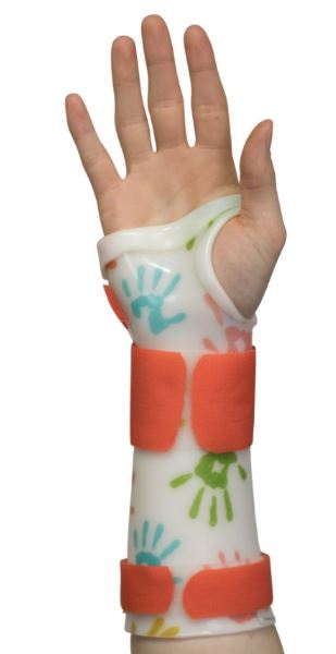 Custom made splints – Geelong Hand Therapy