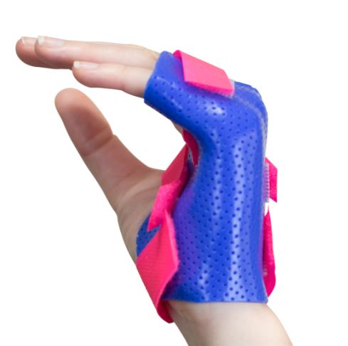 Custom made splints – Geelong Hand Therapy